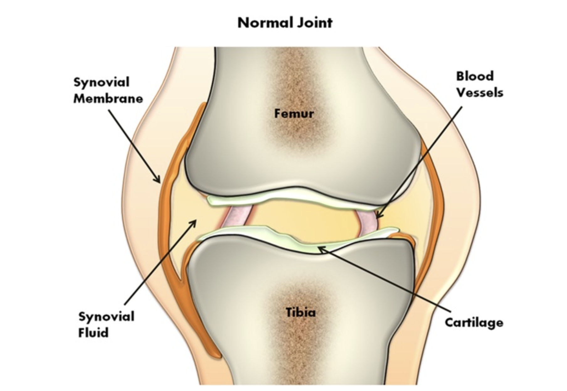 How To Reduce Inflammation In Your Joints - 99WellnessLessons